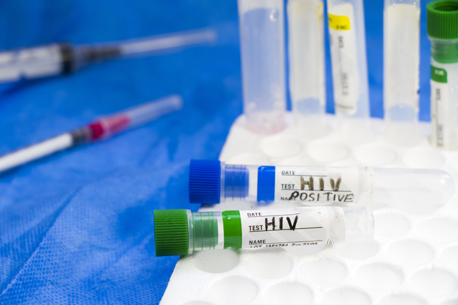 Pesquisadores descobrem nova variante do HIV combinando subtipos ...